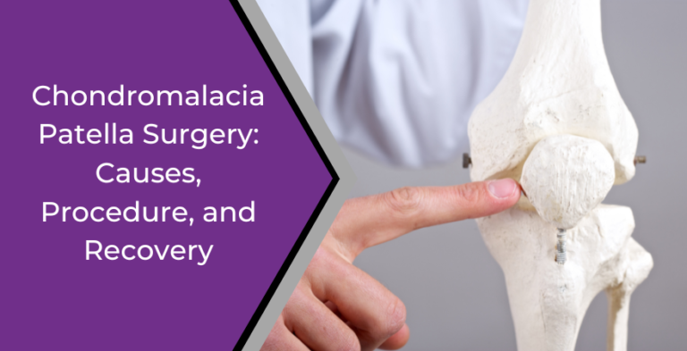 Chondromalacia Patella Surgery: Causes, Procedure, and Recovery