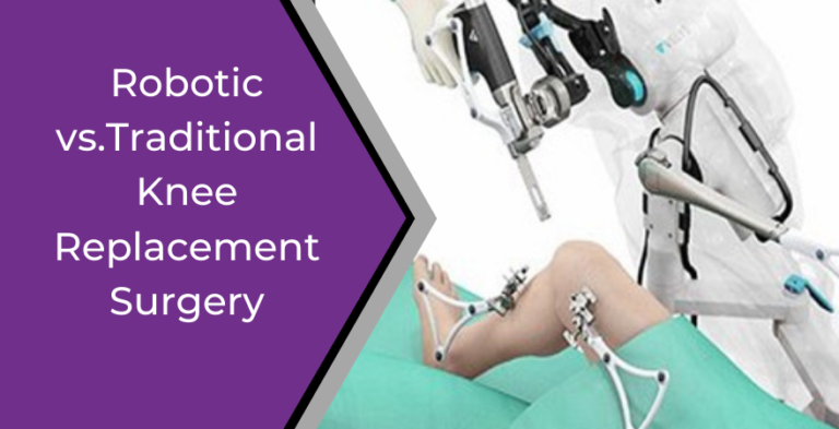 Robotic vs.Traditional Knee Replacement Surgery